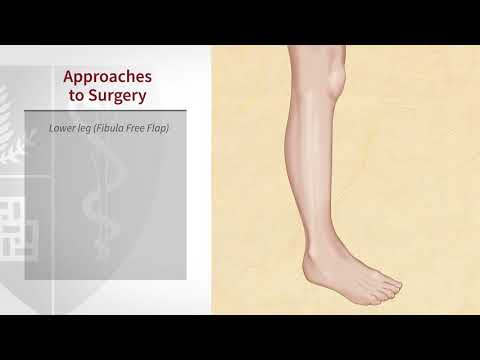 Understanding Reconstructive Surgery for Head & Neck