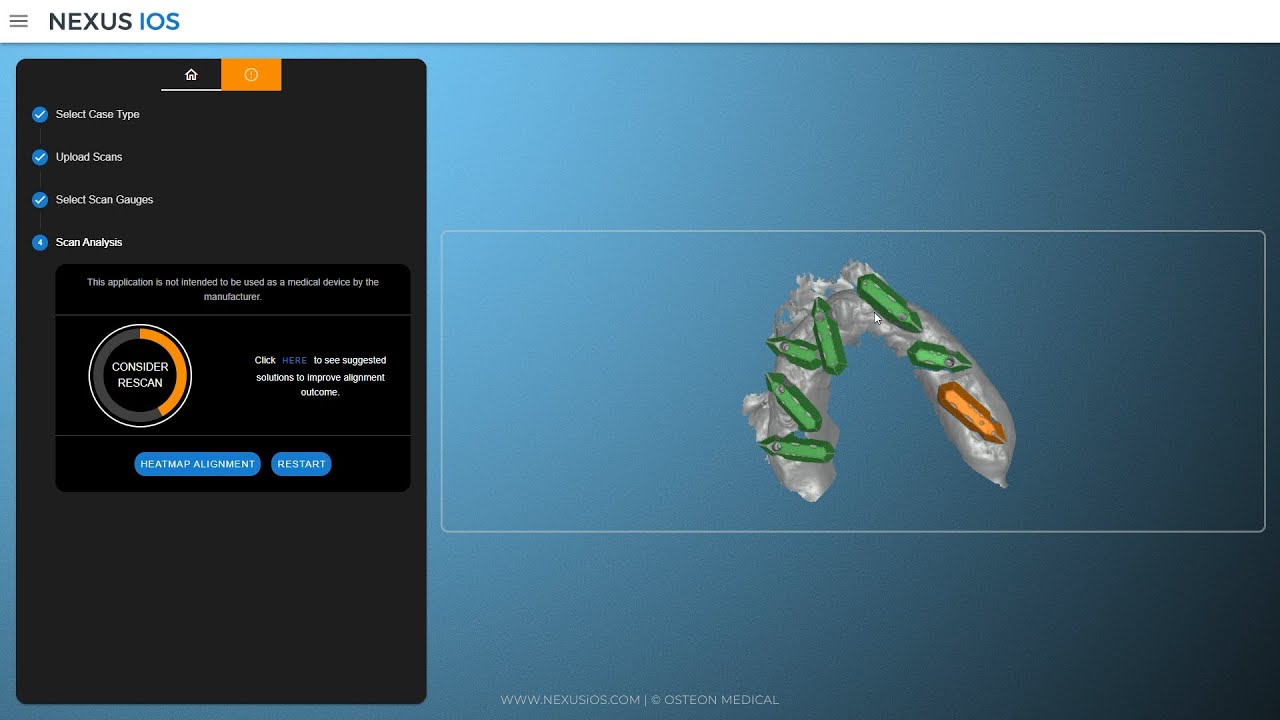Nexus Analyzer - Consider Rescan