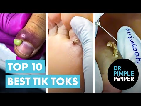 Dr Pimple Popper's Top 10 Best TikToks!