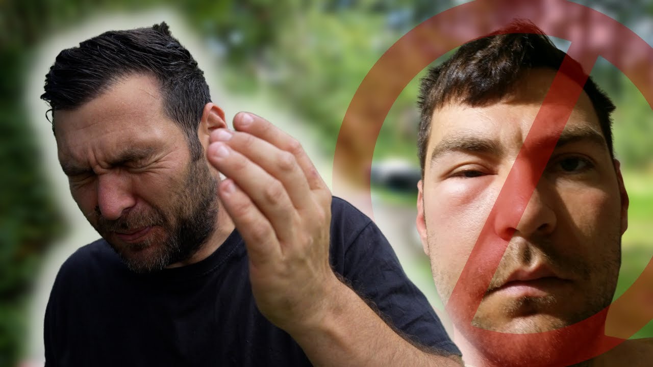 Bees Too Angry To Handle? Here’s How To Fix It Fast