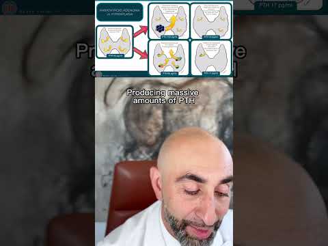 Negative imaging study results for hyperparathyroidism?