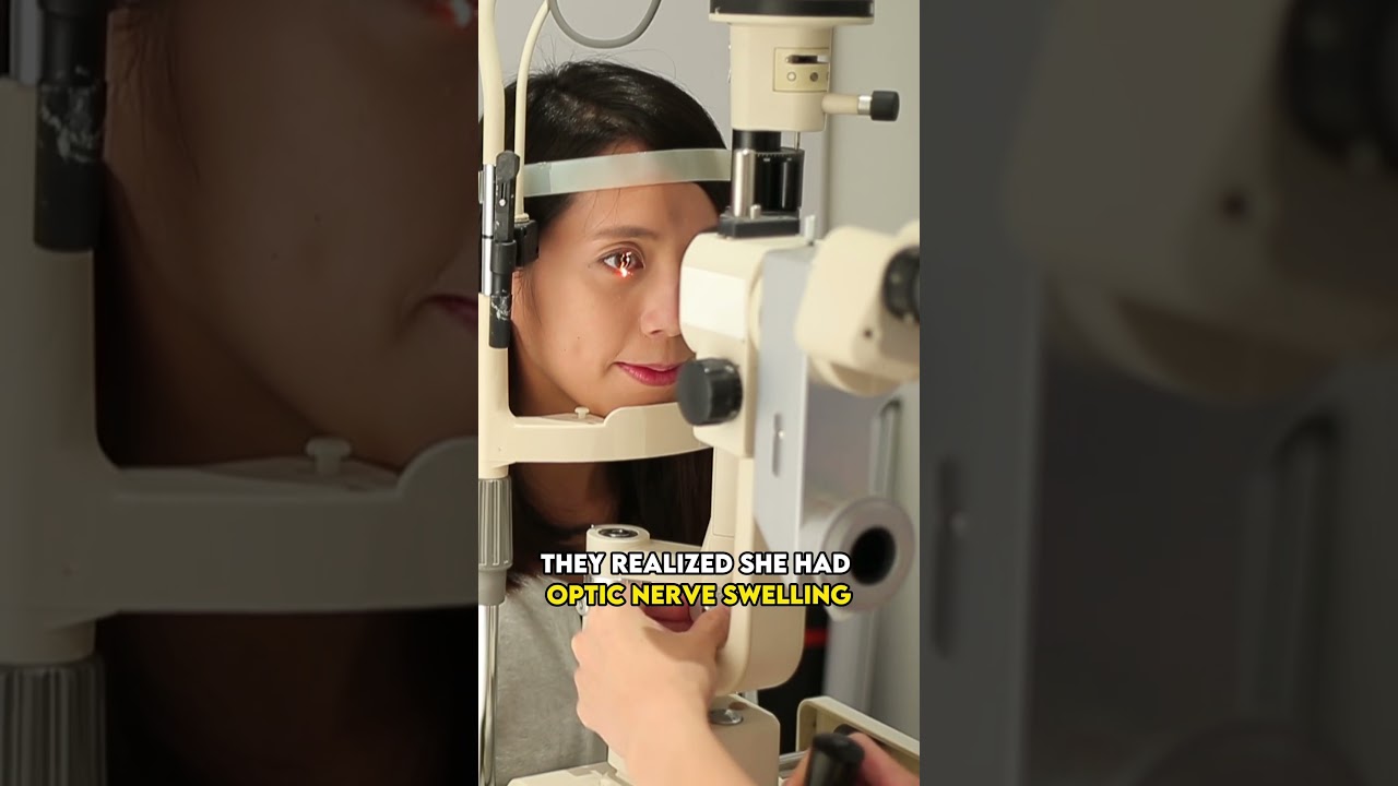 PAPILLEDEMA  PART 1 #shorts