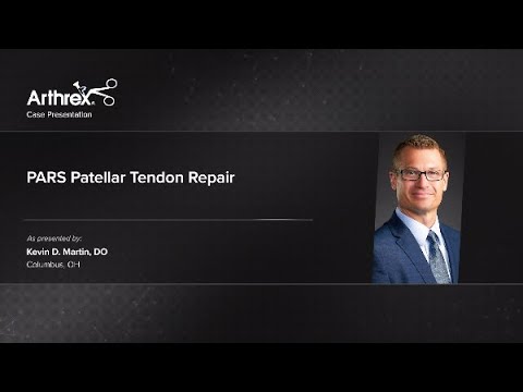 PARS Patellar Tendon Repair