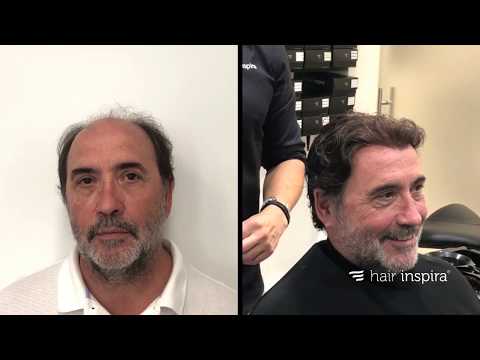 Hair Replacement fitting video (Xavier) part 2 - Hair lnspira
