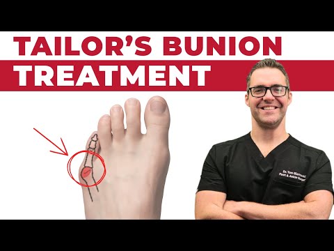 Sharp Pain in the Pinky Toe - Causes & Best Treatment