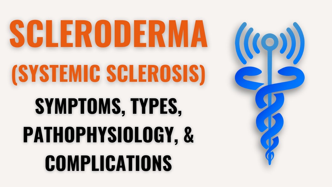 SCLERODERMA SYMPTOMS, PATHOPHYSIOLOGY, TYPES, & COMPLICATIONS