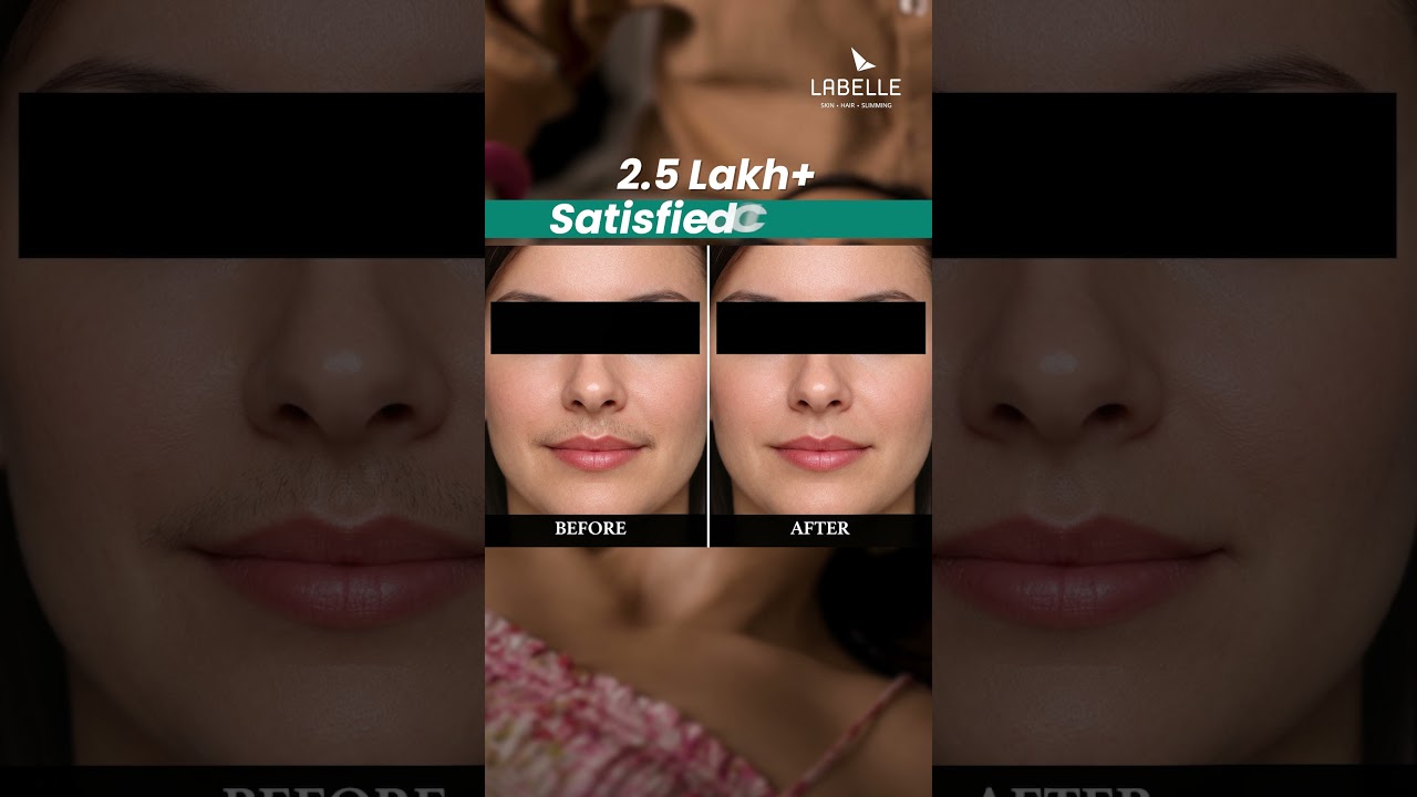 Stop Waxing & Threading Forever | Laser Hair Reduction from ₹1999