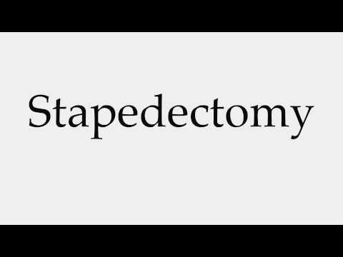 How to Pronounce Stapedectomy