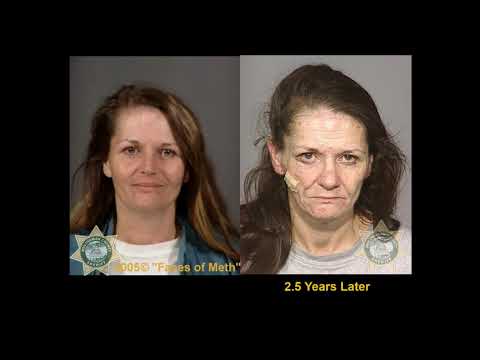 Street Drugs - Faces of Meth (Disturbing Depictions of Drugs)
