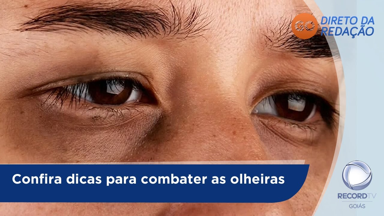 Confira dicas para combater as olheiras