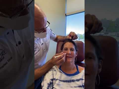 Treating an Uneven Smile with Xeomin