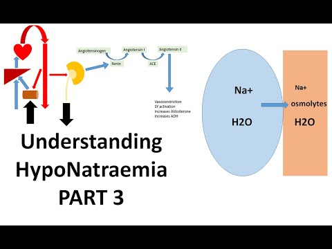 Part 3 of 3 Understanding HypoNatraemia: Osmotic Demyelination syndrome, Approach to HypoNatraemia