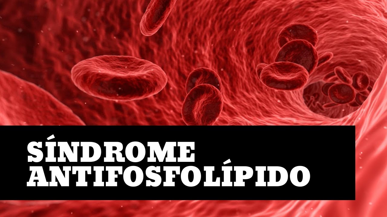 Actualización en Síndrome Antifosfolípido
