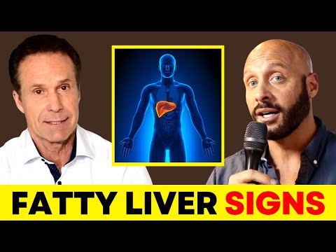 Early Signs Of Nonalcoholic Fatty Liver Disease | Fatty Liver Symptoms & Treatments | Dr Spattini