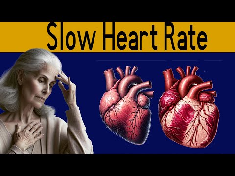 Bradycardia - Top 5 most common cause of Slow Heart Rate