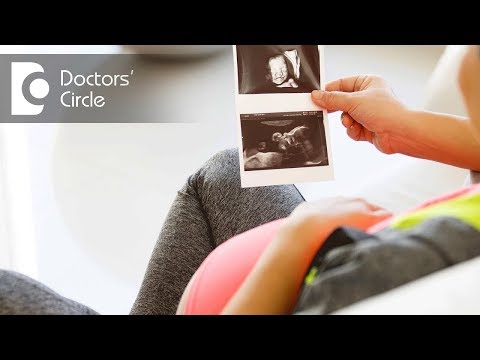 Are tests for genetic disorders accurate in Multiple Pregnancy? - Dr. Shoba Venkat of C9 Hospitals