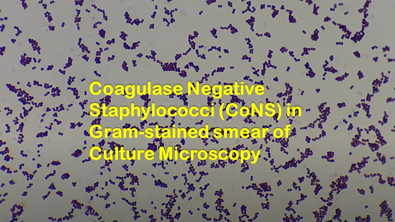 Coagulase Negative Staphylococci (CoNS) in Gram stained smear of culture Microscopy