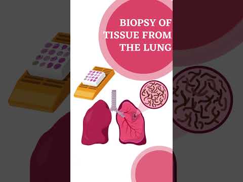 Why do Bronchoscopy? #shorts