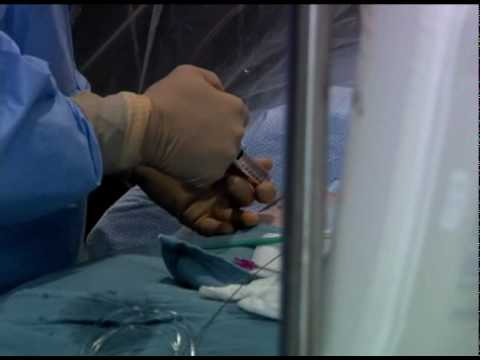 Cardiology ABC Commerical.wmv