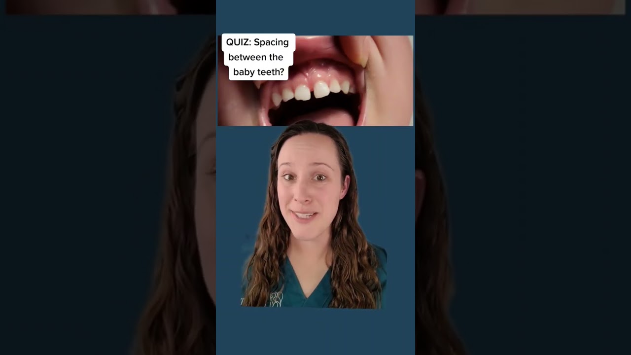 Spaces between baby teeth: normal or no?