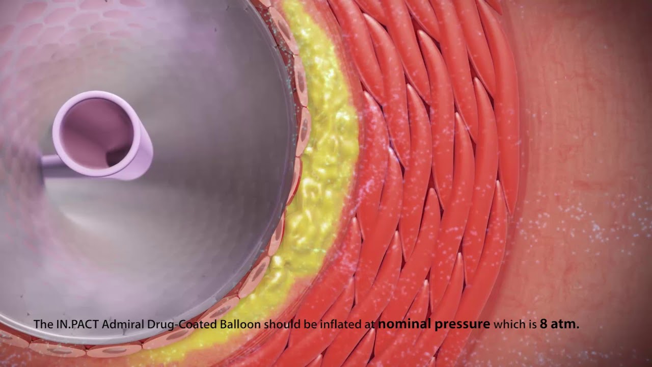 Videos – Deborah Heart & Lung Center