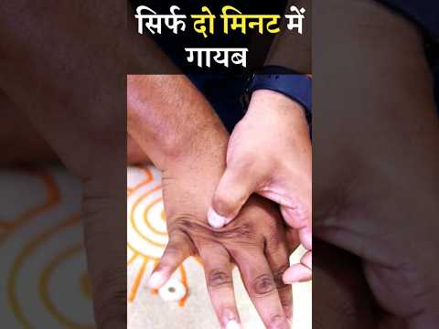 powerful massage for sciatica #youtubeshorts #shorts #shortsfeed #apakahealthguru #sciatica