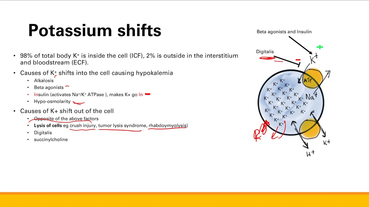 Electrolyte shifts with diuretics | Renal system | Step 1 Simplified