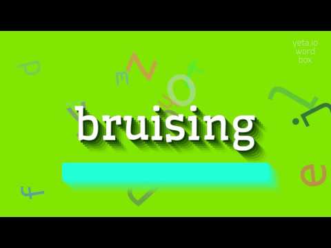 BRUISING - HOW TO PRONOUNCE BRUISING?