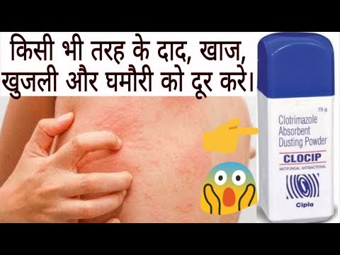 Cipla Antifungal Drugs - Latest Price, Dealers & Retailers in India