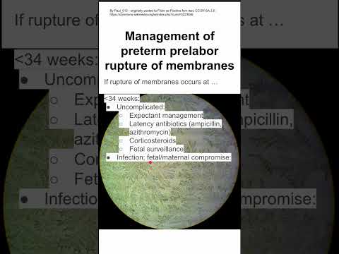 Management of preterm prelabor rupture of membranes