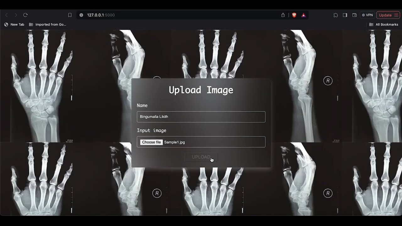 Bone fracture Detection Web Application