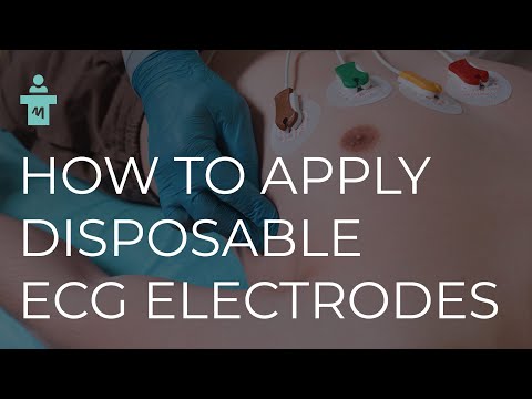 Resting ECG Recording in 12 Leads Using Disposable Electrodes