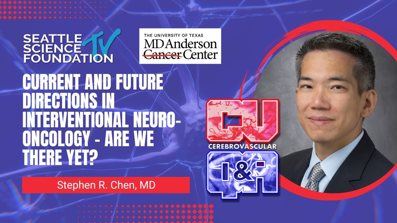 Current and Future Directions in Interventional Neuro-Oncology: Are We There Yet? - Stephen Chen, MD