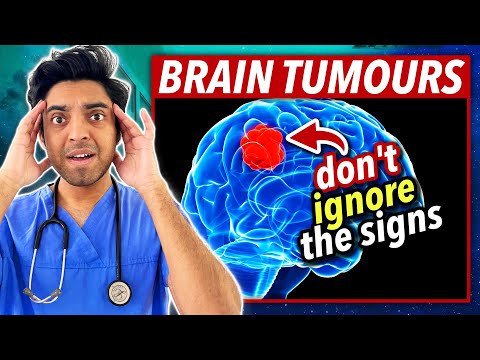Brain Tumour Signs You Should NEVER Ignore — Doctor Explains