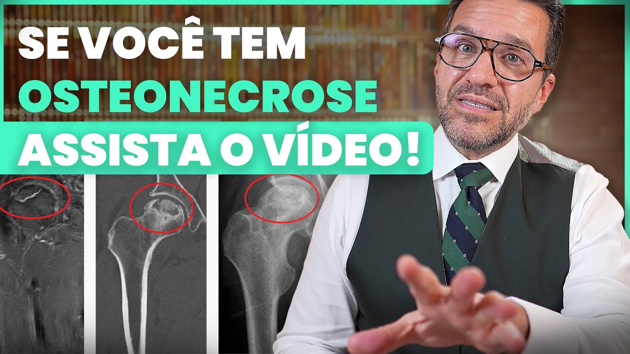 2 ERROS GRAVES de pacientes com OSTEONECROSE! Como tratar a osteonecrose no quadril?