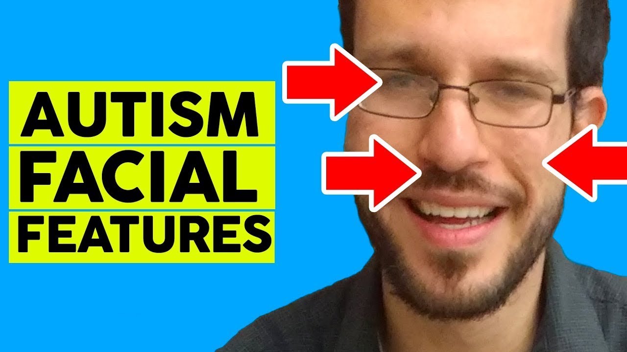 Autism Facial Feature - Aspergers Facial Characteristics