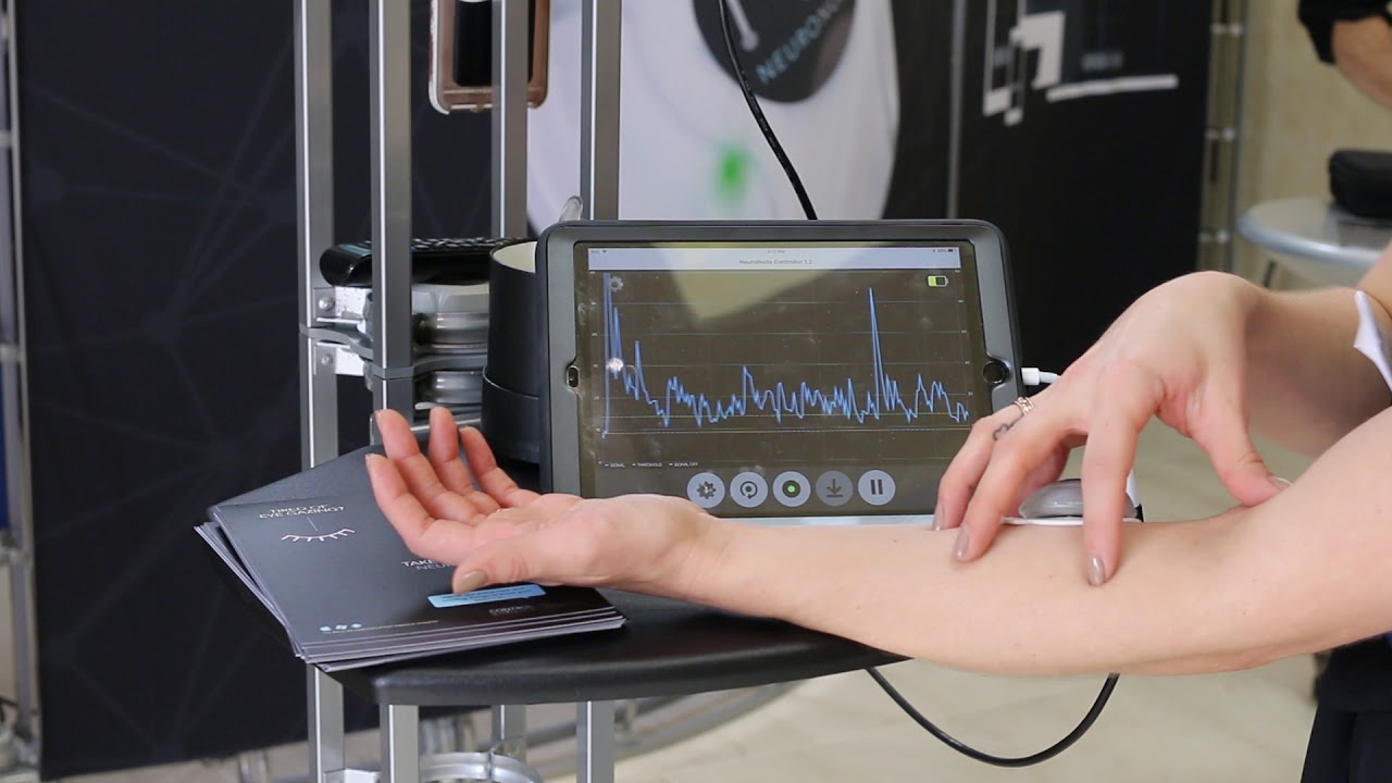 NeuroNode by Control Bionics