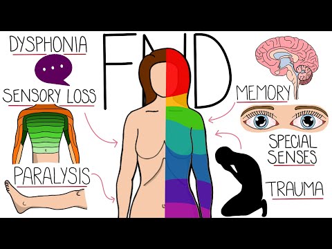 Functional Neurological Disorder (FND) Explained Clearly