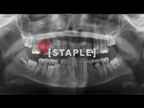 Below The Surface | AAO