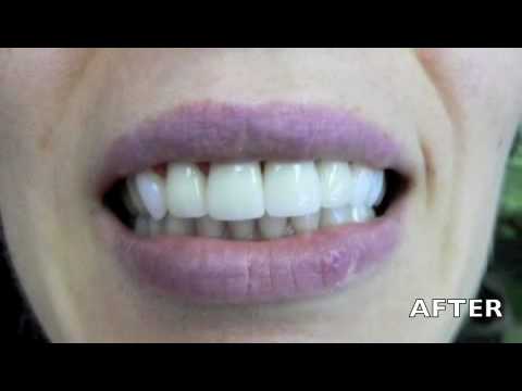 Montclair NJ Dentist: Dr. Jacob Shrayman, DDS Family Dentist in Verona