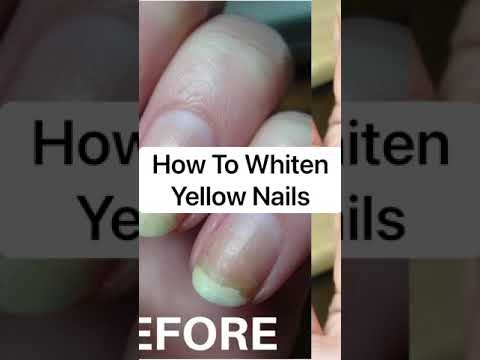 Nail Hack To Whiten Yellow Nails!