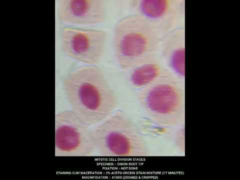 Mitosis - Cell Division different stages under Microscope #biology #neet #agriculture #genetics
