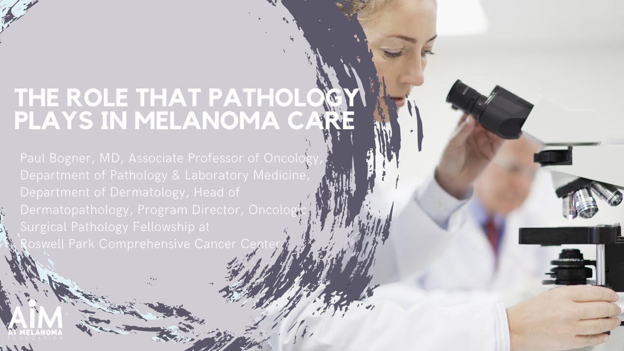 The Role That Pathology Plays in Melanoma Care