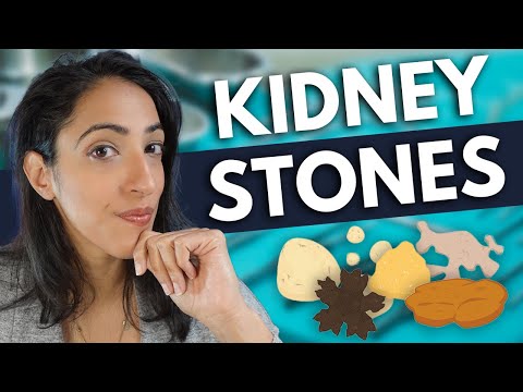How long does it take to pass a kidney stone (size matters!) | Prevention, Symptoms, & Looks ????