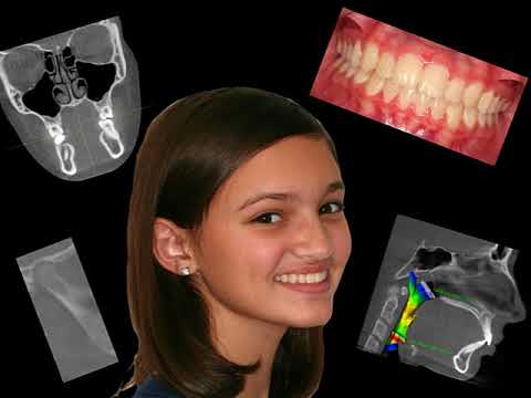 Contemporary Transverse Diagnosis and TAD-Supported Expansion