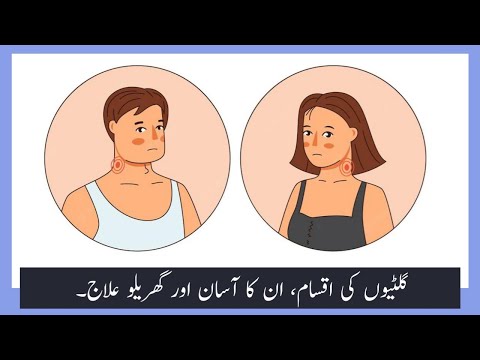 Swollen Lymph Nodes Treatment In Urdu/Hindi - Giltiyon Ka Gharelu Ilaj - Home Remedies