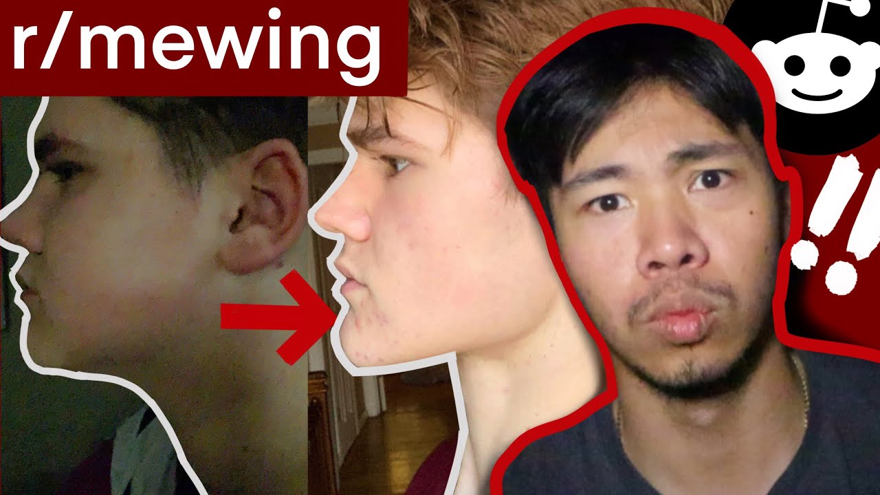 Amazing weight loss + mewing transformation, r/mewing reaction