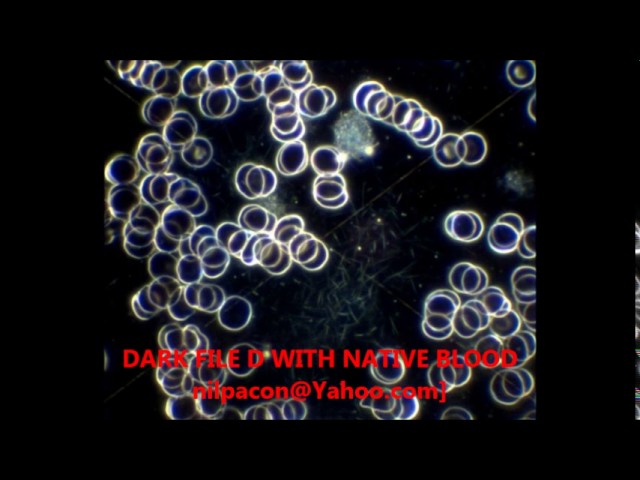 Hund Inverted Microscope - Willovert Standard HF/K Microscope from Mumbai