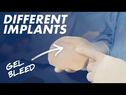 Understanding the Different Kinds of Breast Implants