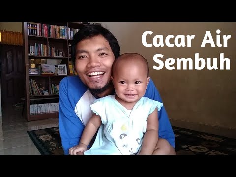 Mengobati dan Merawat Cacar Air pada Anak